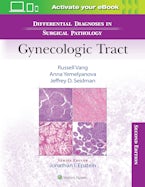 Differential Diagnoses in Surgical Pathology: Gynecologic Tract by ...